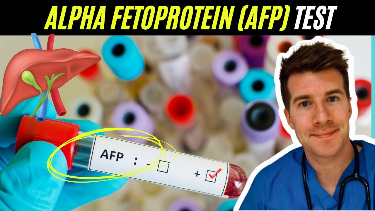 Doctor Explains Alpha Fetoprotein AFP Blood Test Liver And doctor-explains-alpha-fetoprotein-afp-blood-test-liver-and