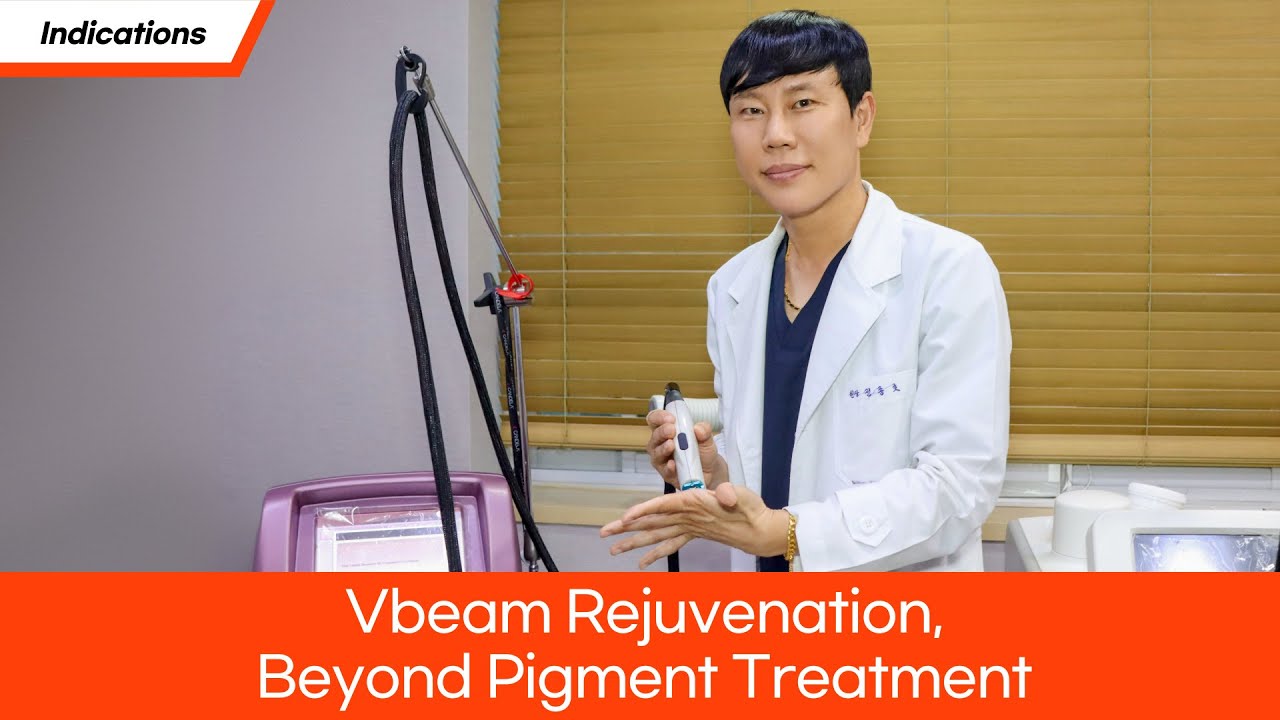 Vbeam Rejuvenation, Beyond Pigment Treatment - YouTube