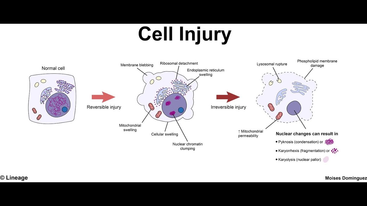 pathogenesis of cell injury - YouTube