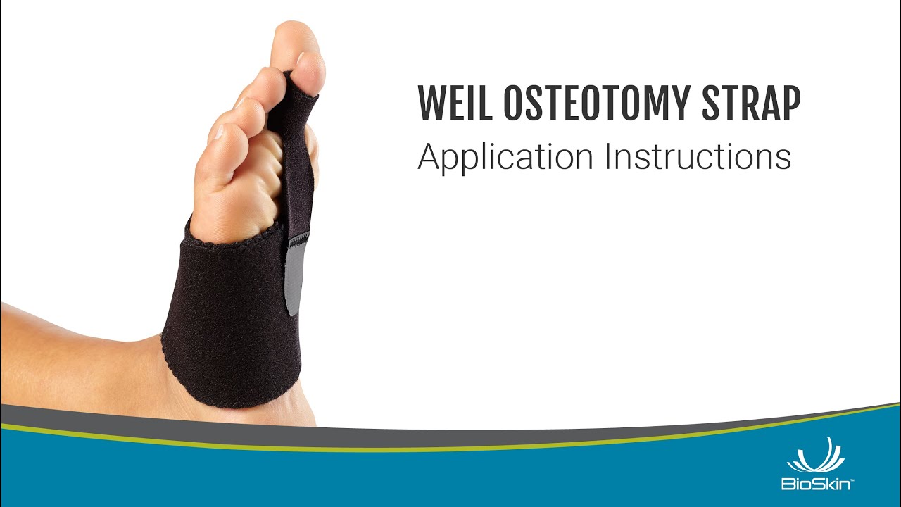 Weil Osteotomy Strap Application Instructions - YouTube