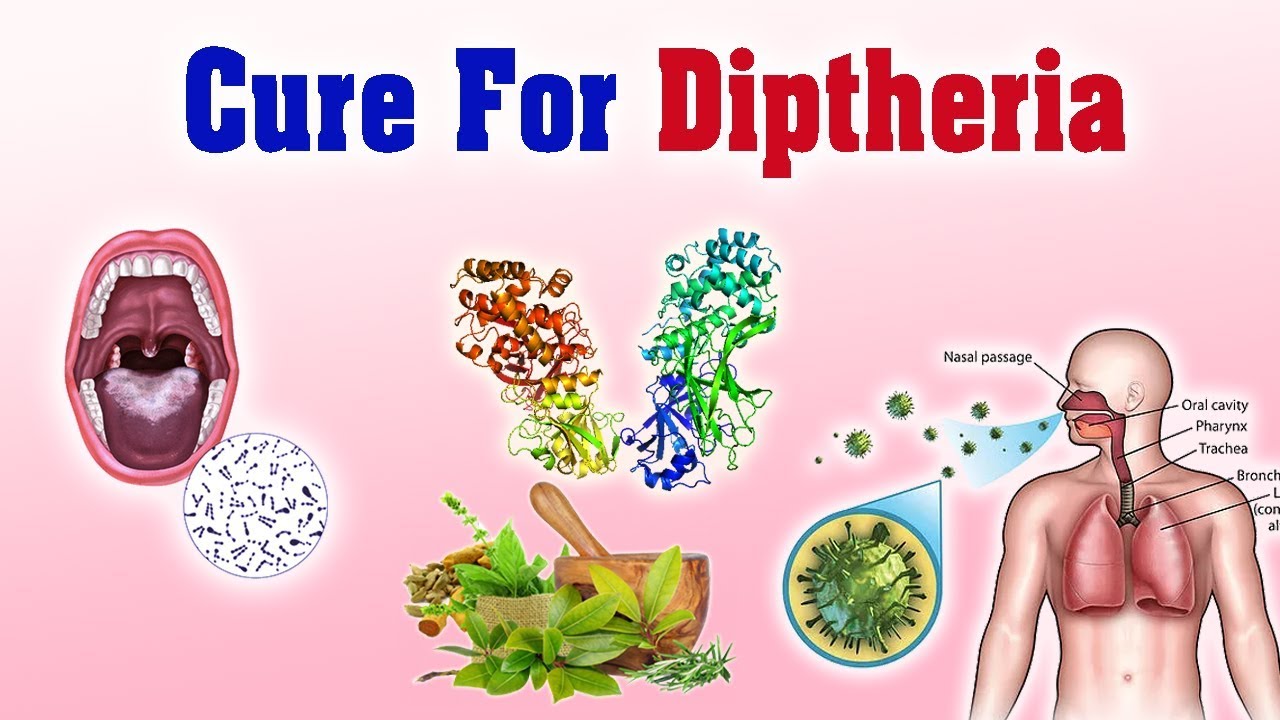 Diphtheria (गलघोटू) - Ayurvedic Treatment || Symptoms and Causes - YouTube