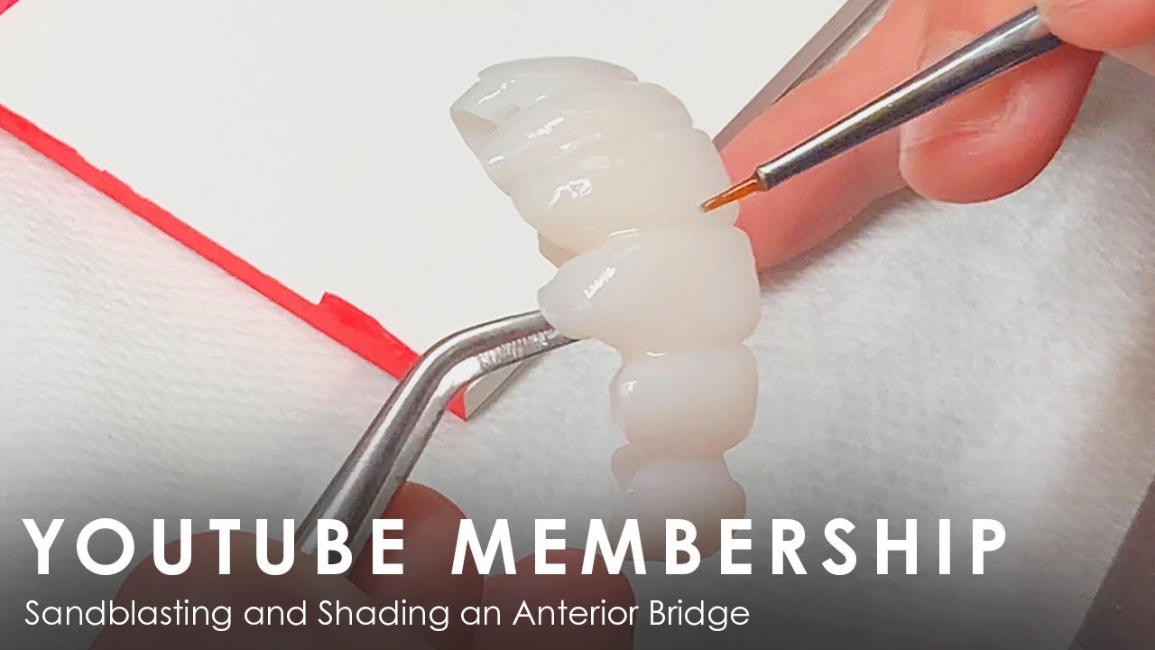 Sandblasting and Shading an Anterior Bridge - YouTube
