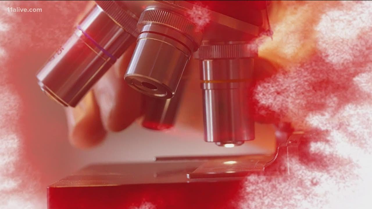 Still immune? 11Alive's Andy Pierrotti checks for COVID antibodies one ...