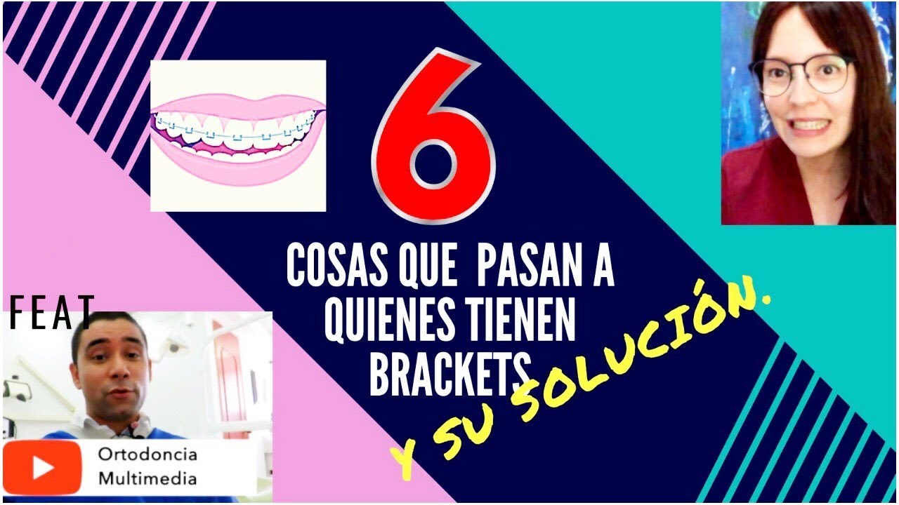 6 COSAS que te pasan si tienes BRACKETS y cómo SOLUCIONARLO ft ...