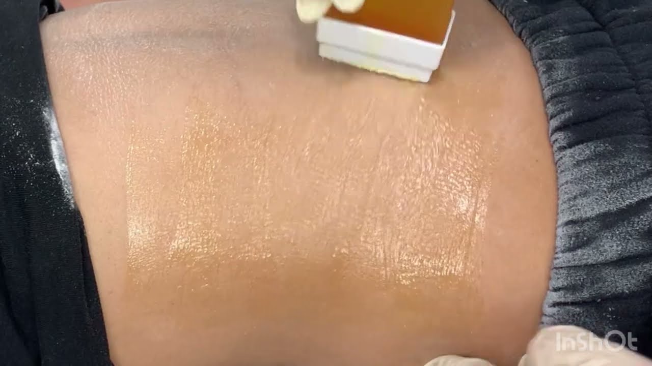 😱Belly waxing 😱Body Hair Removal//How to use applicator roll on wax ...