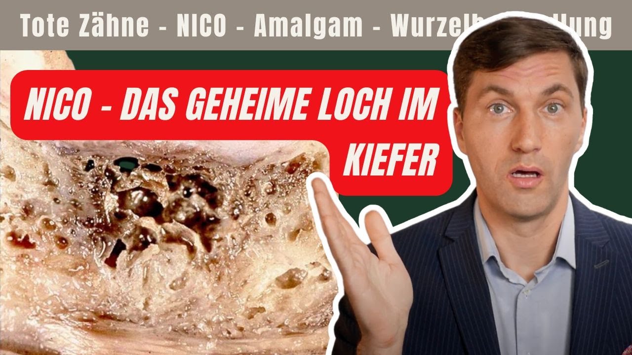 Warum dich deine Weisheitszahnentfernung krank machen kann - FDOK ...
