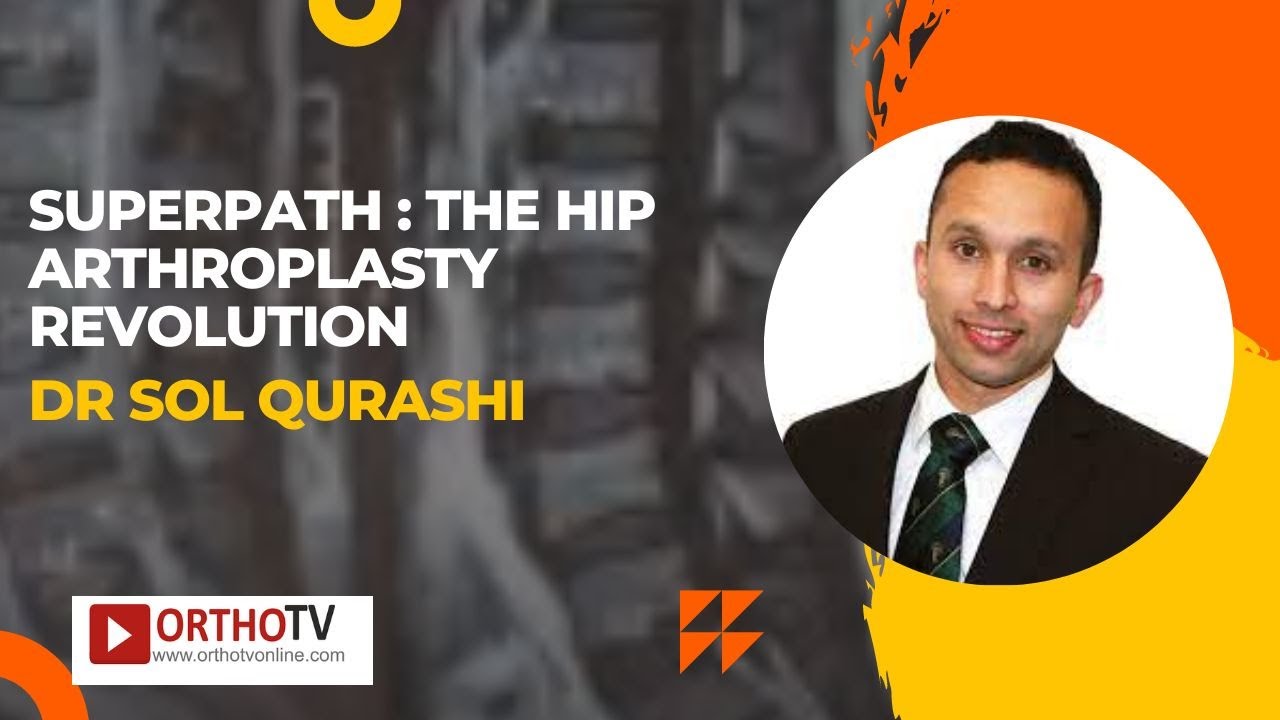 SuperPath - The Hip Arthroplasty Revolution - YouTube