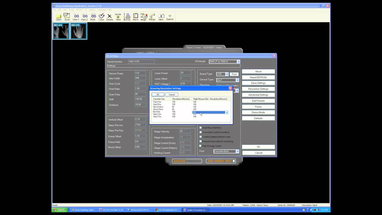 Changing Detail Resolution - X-Scan Series - YouTube