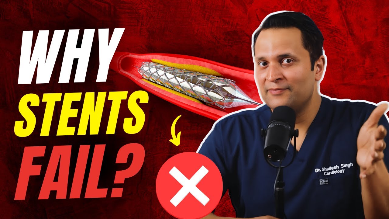 Why heart Stents Fail? Explained by Cardiologist - YouTube