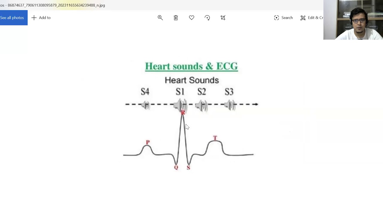 Simple approach to tachycardia- 1st class - YouTube