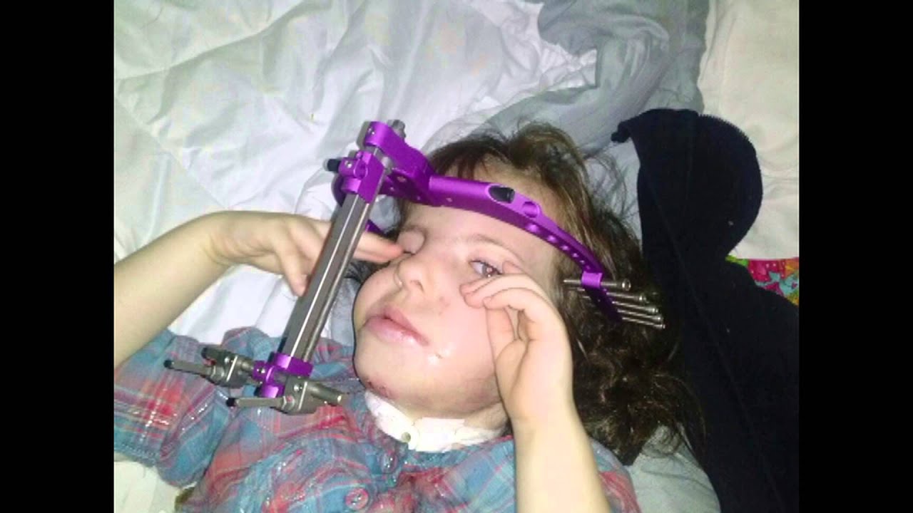 CHLOE COOPER STORY / BY KENNY LEE / FROM NCS TV SHOW - YouTube