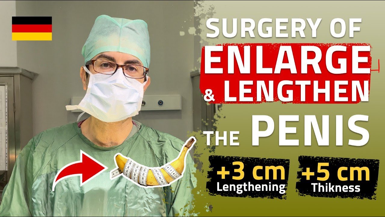 Penis Enlargement Surgery !! (lengthening +3 cm, thickening +5 cm ...