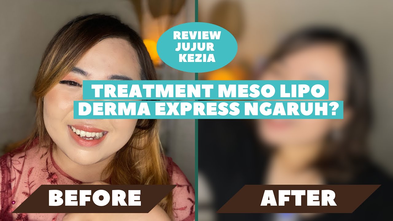 REVIEW JUJUR DERMA EXPRESS TREATMENT MESO LIPO NGECILIN PIPI & DOUBLE ...