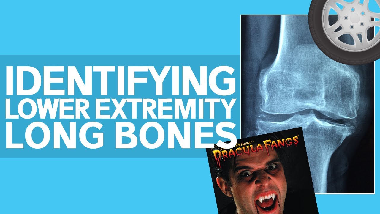Long Bones of the Leg (Made Super Easy) - YouTube