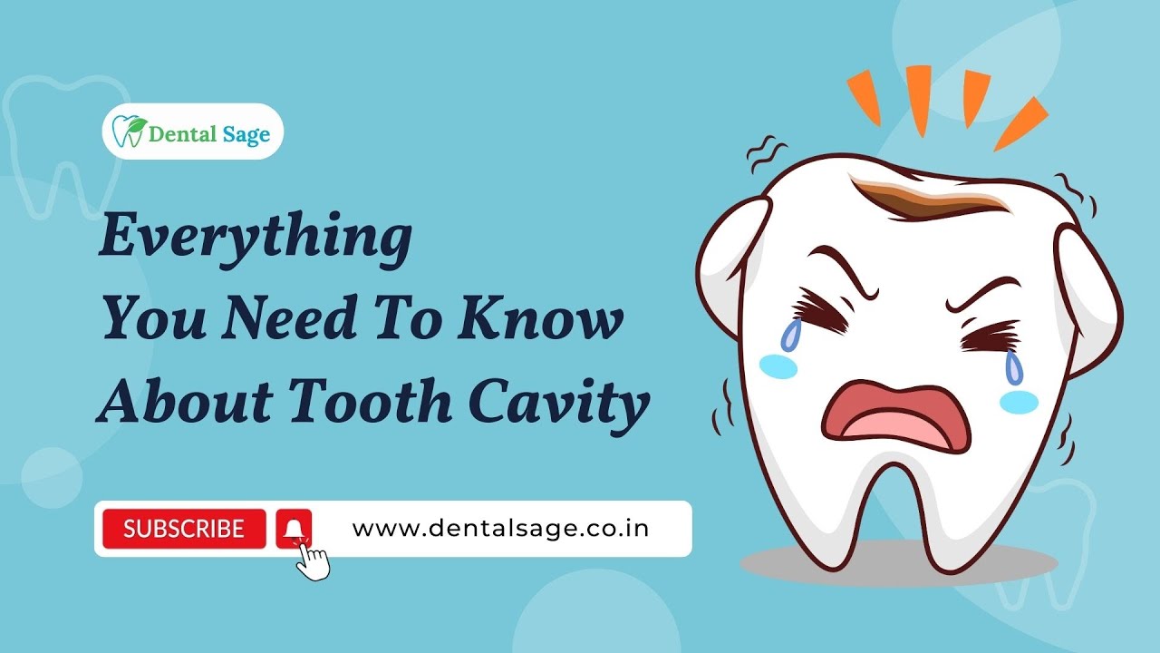 Podcast: Everything You Need To Know About Tooth Cavity | Dental Clinic ...