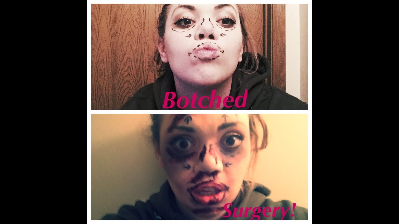 Botched Plastic Surgery Halloween Makeup Tutorial!! - YouTube