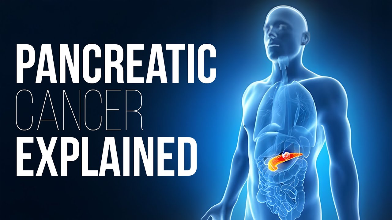 Apollo Hospitals | FAQs on Pancreatic Cancer | Dr. K J Raghunath - YouTube