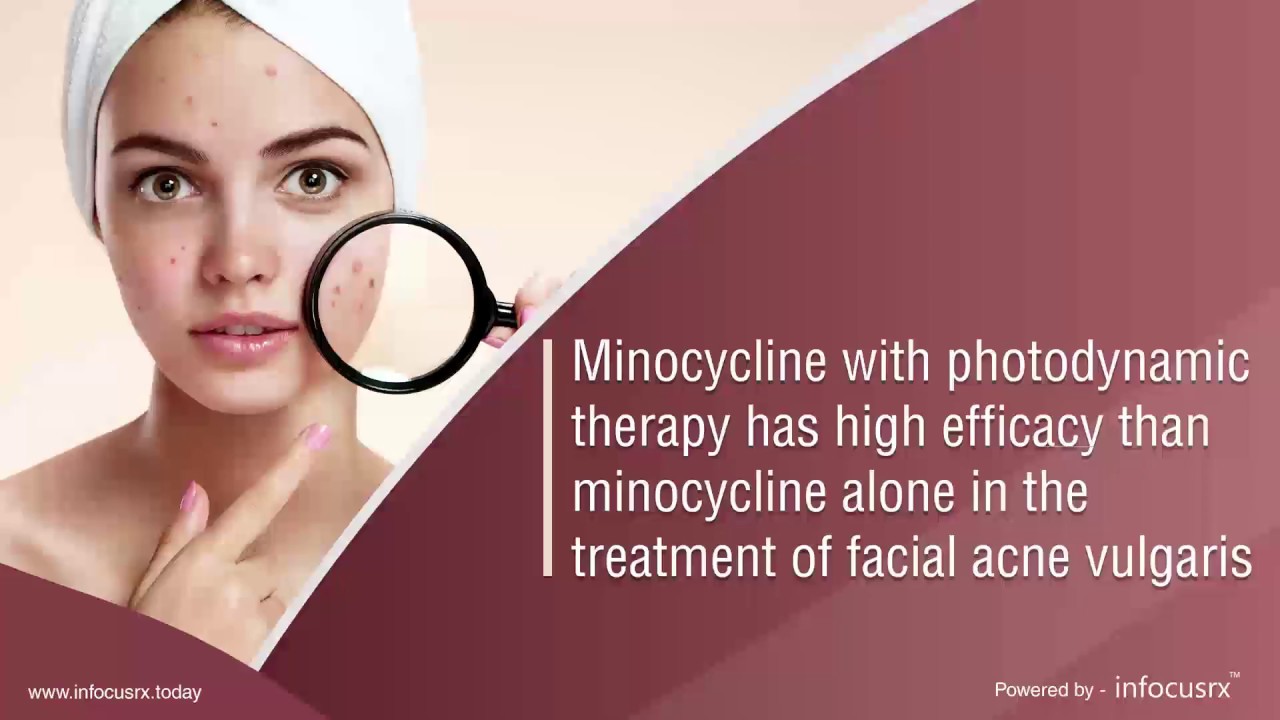 Minocycline, photodynamic therapy is efficacious than minocycline in ...