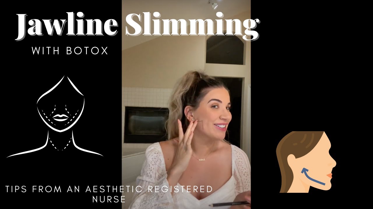 How I Like to Place Botox ll Jawline Slimming and Masseter Reduction ...