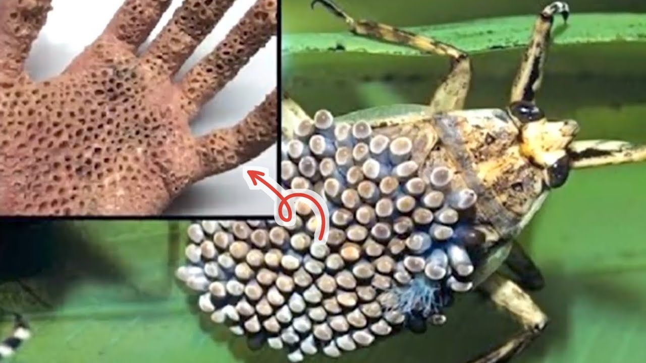 "Killer Bugs: Meet The World's Most Lethal Top 10 Insects"@nazitvofficial - YouTube
