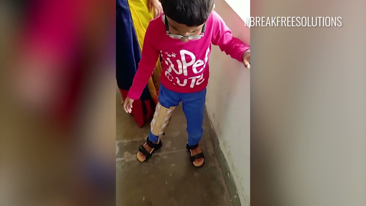 Technique to assist paraplegic kids in walking | Break Free Solutions ...