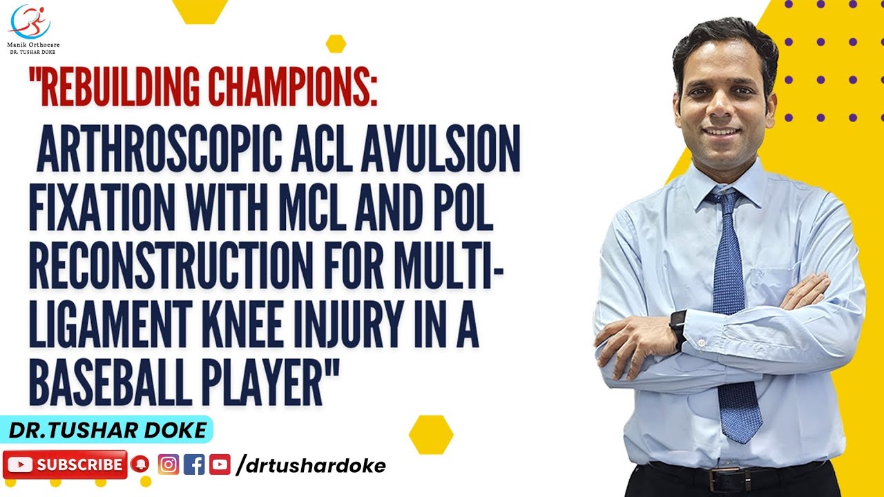 "Advanced Surgery: Fixing ACL Avulsion & MCL Reconstruction in Baseball ...
