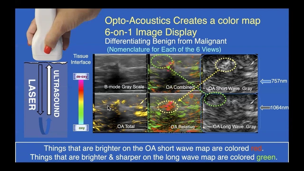 Opto-Acoustic Imaging: How this New Hybrid Modality Can Impact Your ...