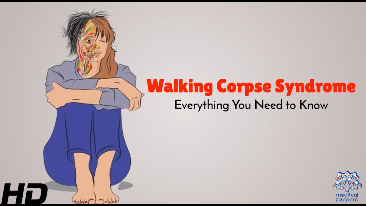 Walking Corpse Syndrome: Myths, Facts, and Everything In Between - YouTube