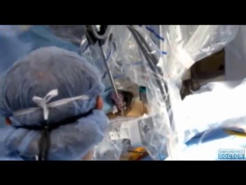 Bladder Cancer Patients Can Benefit from Radical Robotic Bladder ...