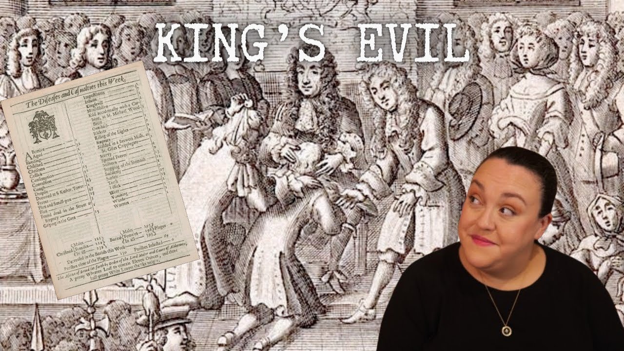 French Pox, Bloody Flux and Other Historical Illnesses - YouTube