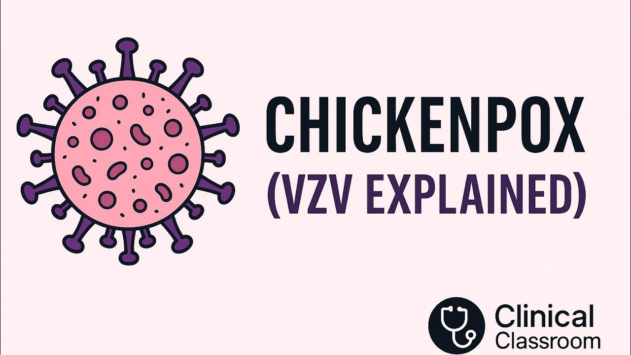 Chickenpox (Varicella-Zoster Virus) Explained | Symptoms, Pathogenesis ...