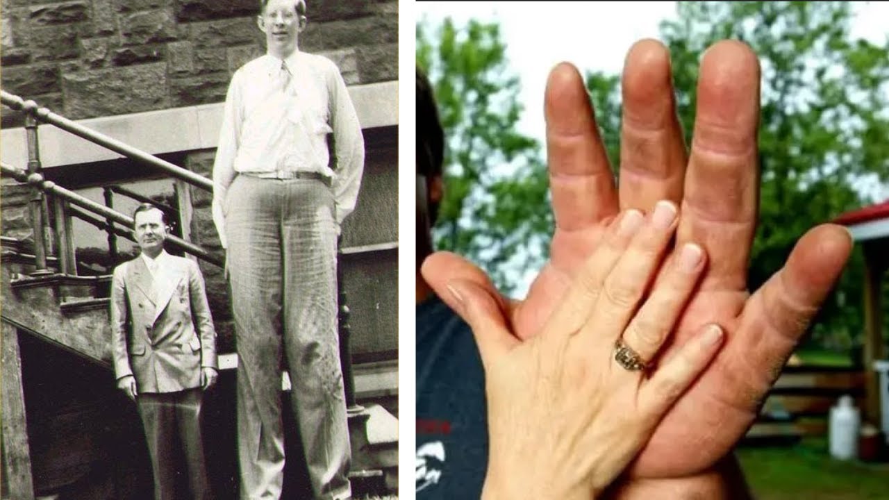 Top 10 Real Life Giants From History - YouTube