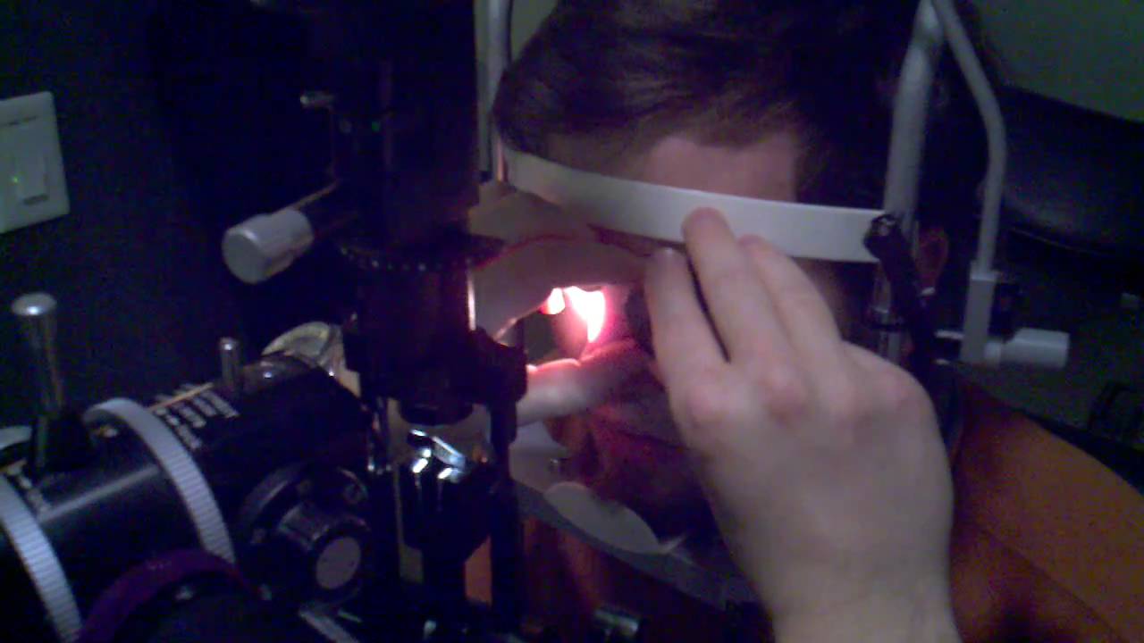 Practicing Gonioscopy - YouTube