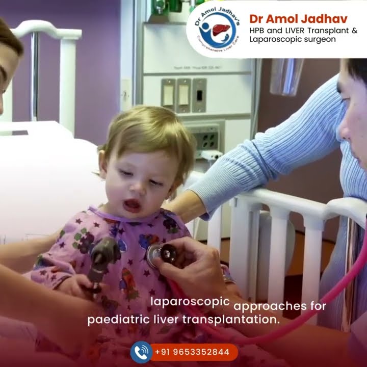 Minimally Invasive Liver Transplants: Navigating Challenges in Children ...