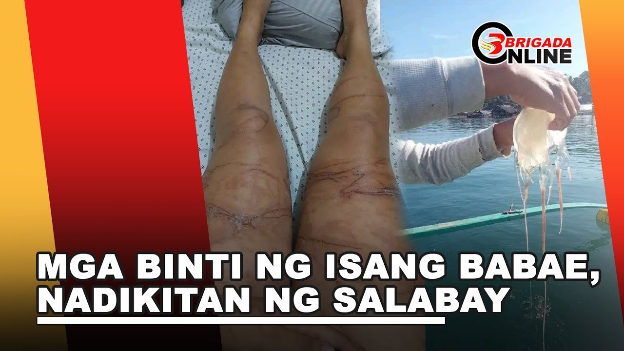 Mga binti ng isang babae, nadikitan ng salabay - YouTube