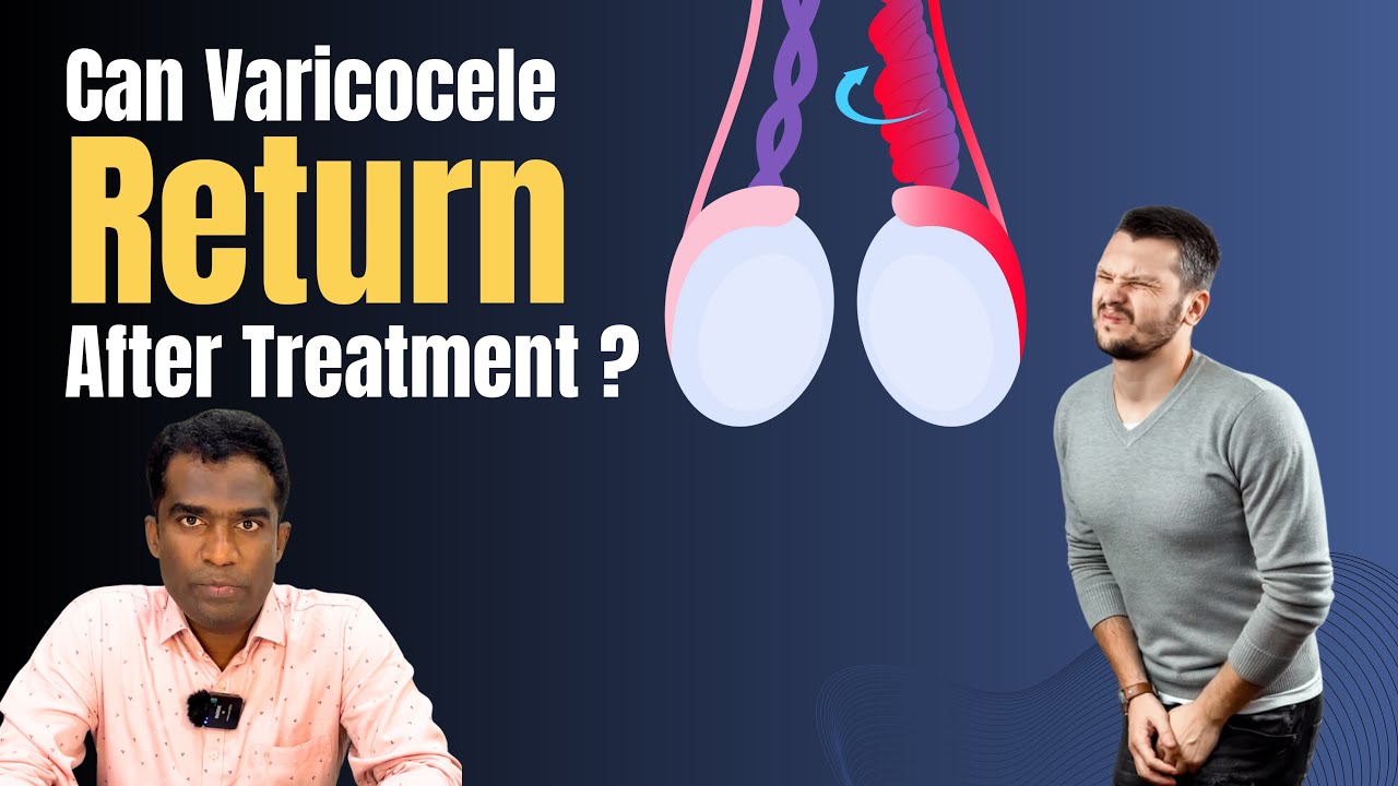 Can Varicocele Return After Treatment ? Varicocele Treatment in ...