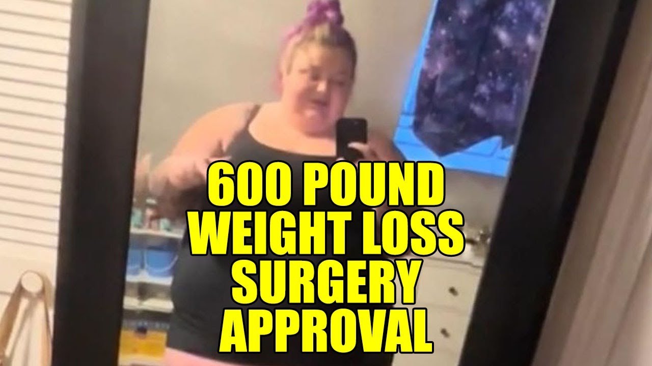 The Weight Loss Surgery Approval Process For A 600 Pound Woman - YouTube