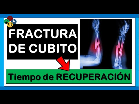 FRACTURA de cubito REHABILITACIÓN | TIEMPO de RECUPERACIÓN - YouTube