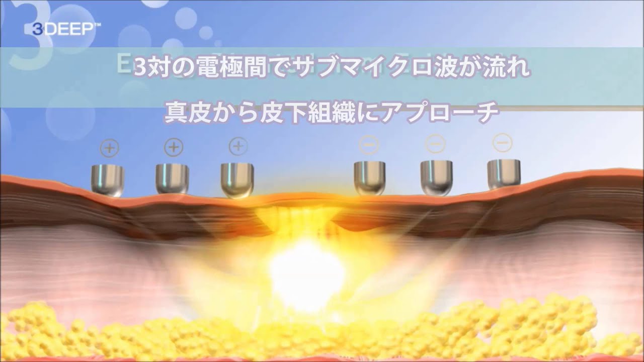 [newaリフト] ひきしめの秘密 3DEEPテクノロジー - YouTube