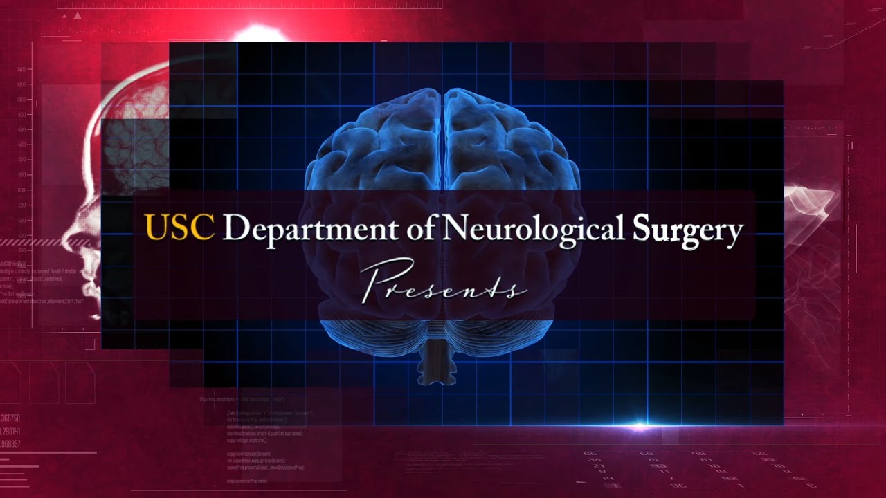 Dr. Kenneth Liu Presents: Intracranial Venous Stenting - YouTube
