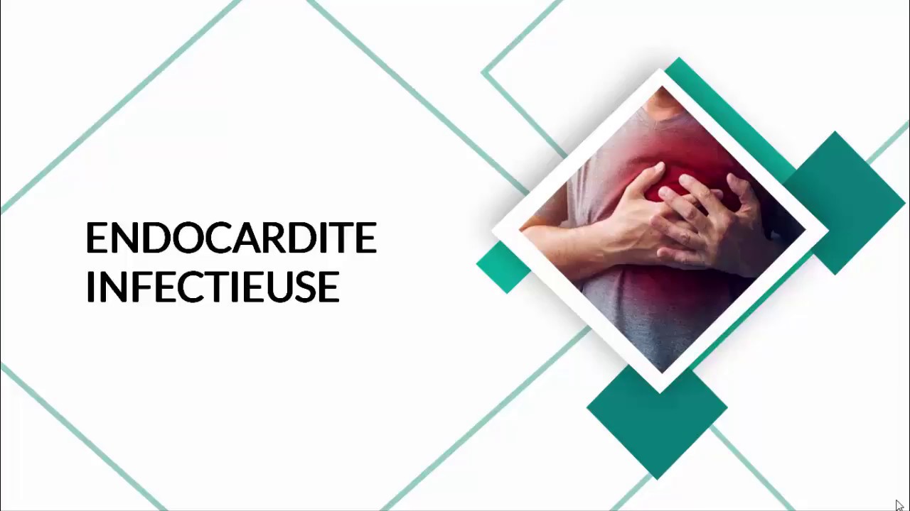 Cardiopathe et soins dentaire | Endocardite infectieuse | prise en ...