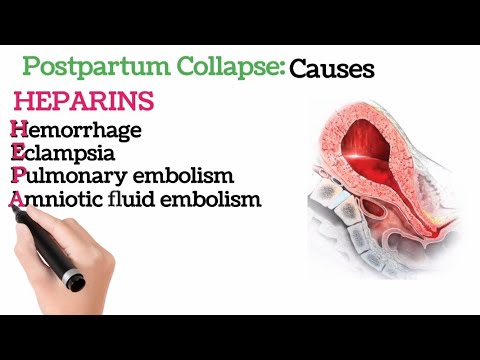 Postpartum Collapse Causes - YouTube