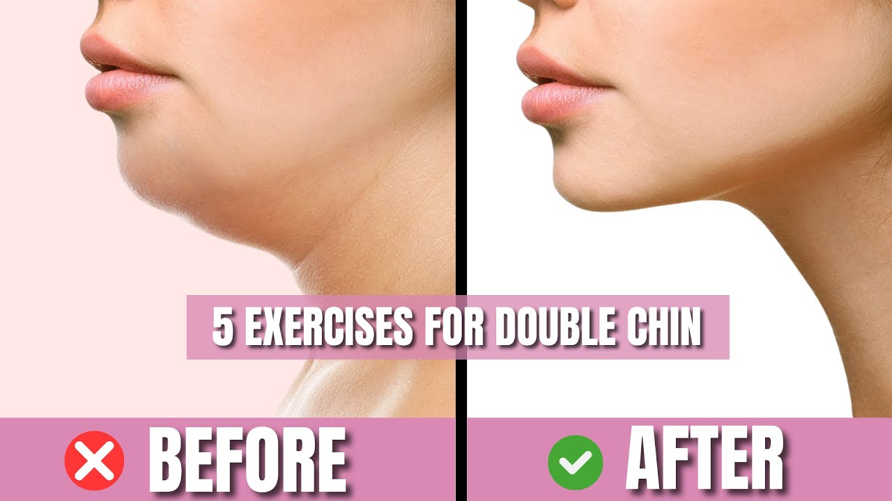5 Effective Exercises to Reduce Your Double Chin Fastly! - YouTube