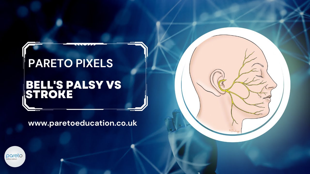 Bell's Palsy vs Stroke: A Simple Explanation - YouTube