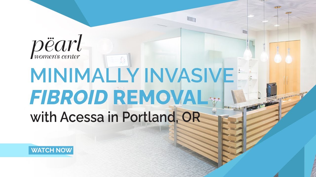 Fibroid Removal: Minimally Invasive Acessa in Portland, OR | Pearl ...