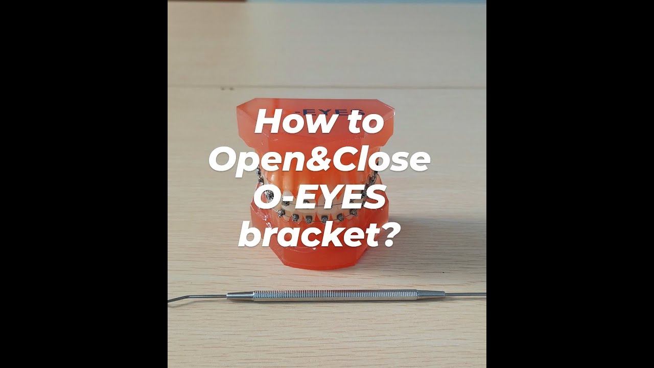 OO Dental | Opening&Closing of O EYES Bracket - YouTube