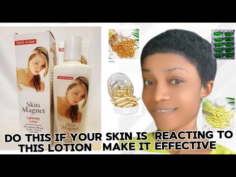 SKIN MAGNET LIGHTENING LOTION REVIEW HOW TO STOP THIS LOTION REACTING ...