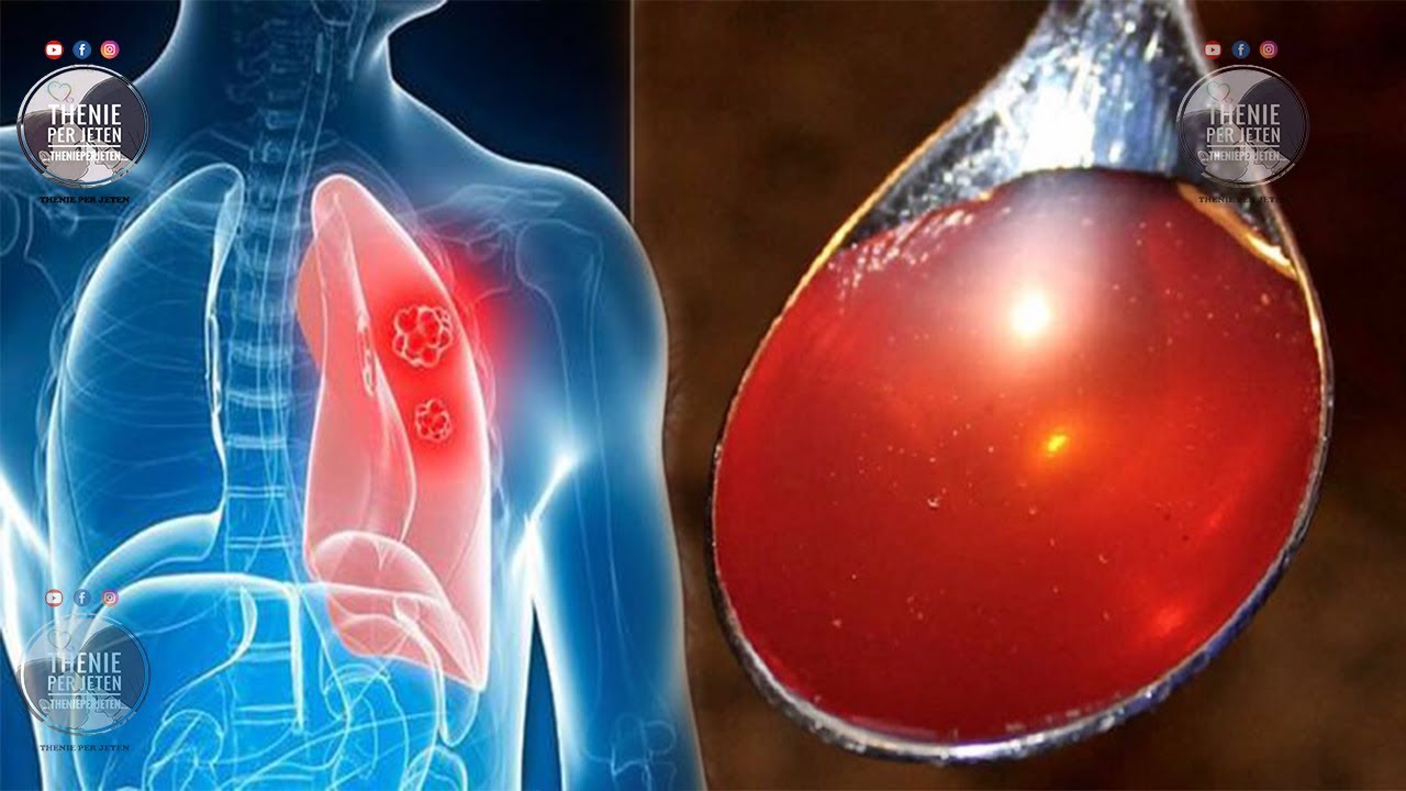 Mjeku zbulon ila'cin më të fortë natyror që largon çdo lloj infeksioni ...