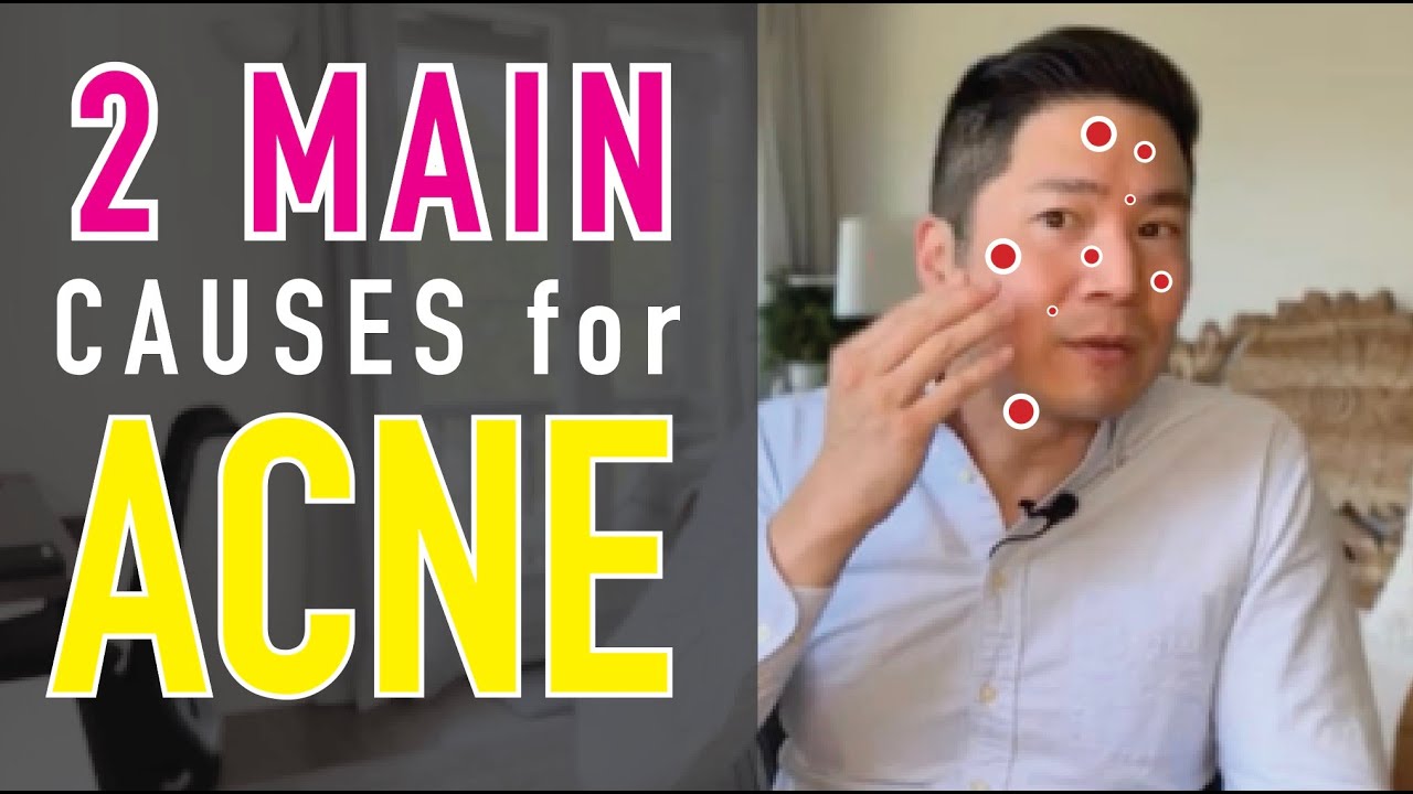 What Causes Acne | 2 Main Reasons Why Breakouts Happen - YouTube