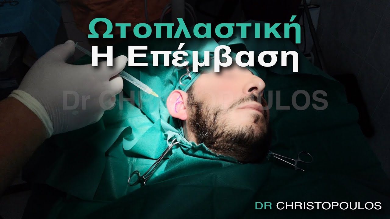 Ωτοπλαστική Πλαστικός Χειρουργός - YouTube